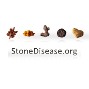 Kidney Stone Photos | StoneDisease.org